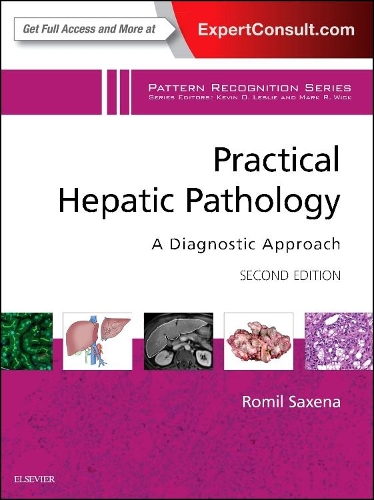 Книга «Practical Hepatic Pathology: A Diagnostic Approach: A Volume in ...
