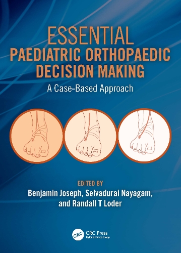 Книга «Essential Paediatric Orthopaedic Decision Making: A Case-Based Approach» – , купить по ...
