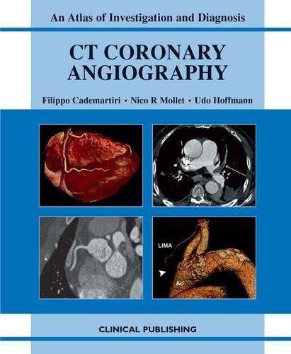 Книга «CT Coronary Angiography: Atlas of Investigation and Management ...