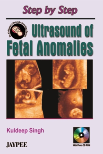 Книга «Step by Step Ultrasound of Fetal Anomalies» – Кулдип Сингх ...