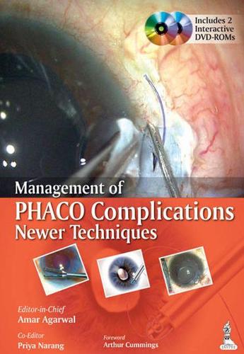 Книга «Management of Phaco Complications: Newer Techniques» – Амар Агарвал, купить по цене 0 на ...