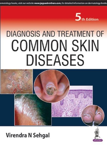 Книга «Diagnosis and Treatment of Common Skin Diseases» – Вирендра Н ...